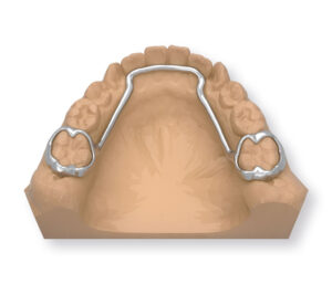 Digitaler Lingualbogen